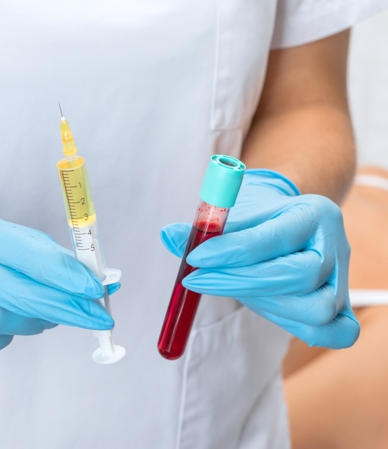 Platelet-Rich Fibrin (PRF) – Te Glow